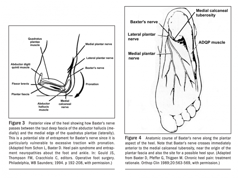 Heel Pain | Cheltenham Podiatry